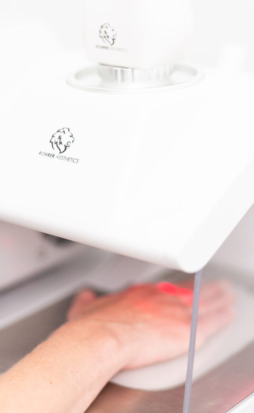 Phoenix CO2 Laser - Peraza Dermatology Group